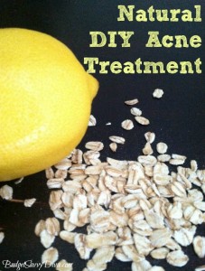 How to Make a Natural DIY Acne Treatment - Budget Savvy Diva