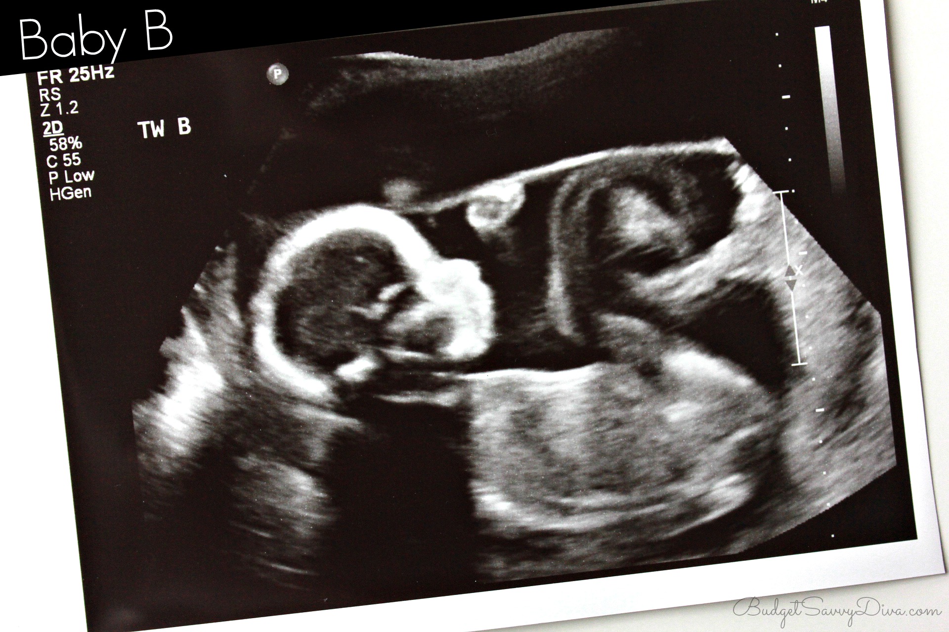 22 Weeks Pregnant With Twins Update - Budget Savvy Diva