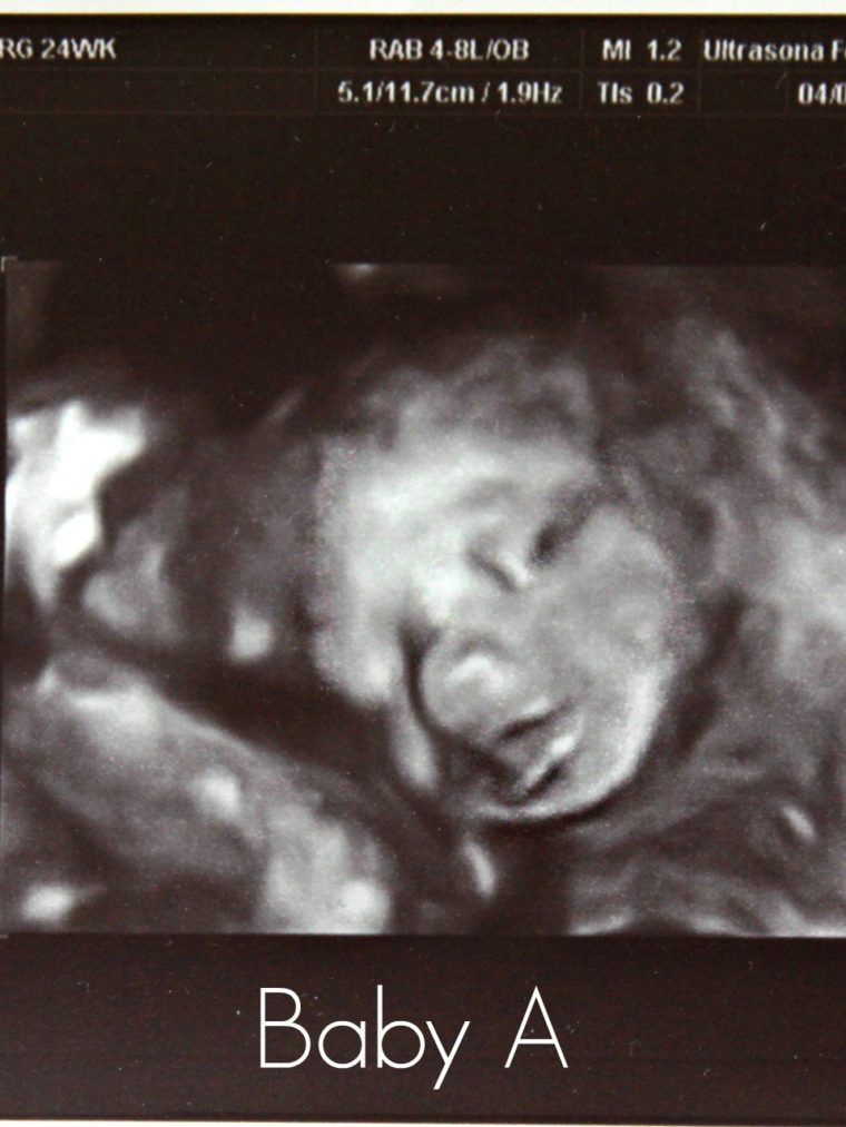 Scary Ultrasound Photo Of My Baby - Budget Savvy Diva