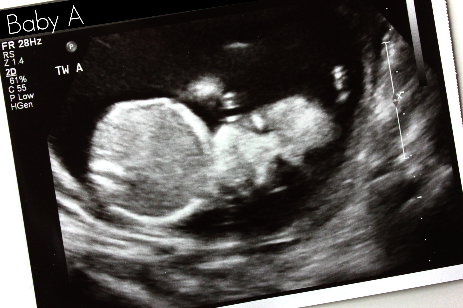 22 Weeks Pregnant With Twins Update - Budget Savvy Diva