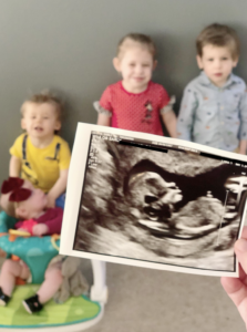 12 Week Ultrasound for Baby #5 - Budget Savvy Diva
